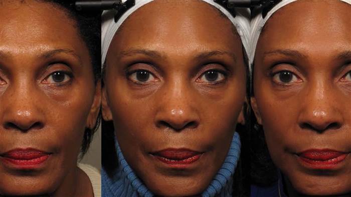 Face It: Facial Exercises That Can Improve Your Appearance
